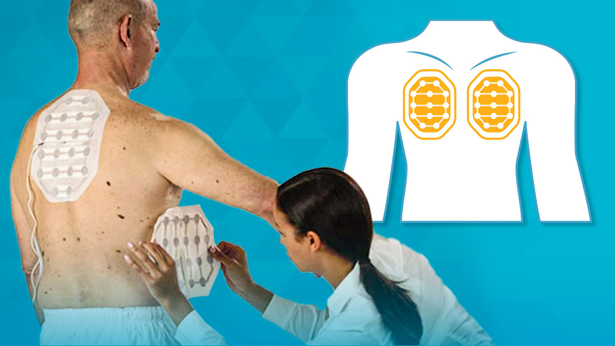 Novacure’s Wearable Lung Cancer Treatment Device, Optune Lua, Receives ...